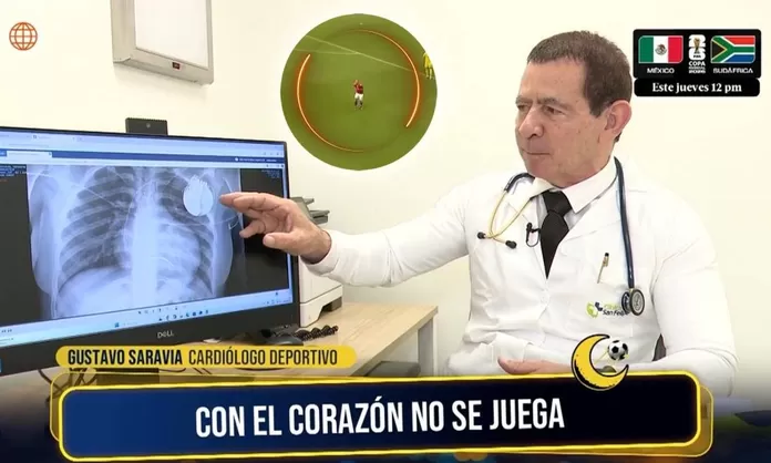 Cardiólogo contó qué le salvó la vida al danés Christian Eriksen ...