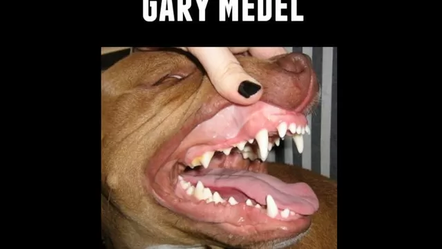Gary Medel no se salvó de los memes tras perder un diente y ser operado ...