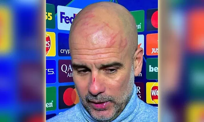 Guardiola y los rasguños en el rostro tras empate del City | América ...