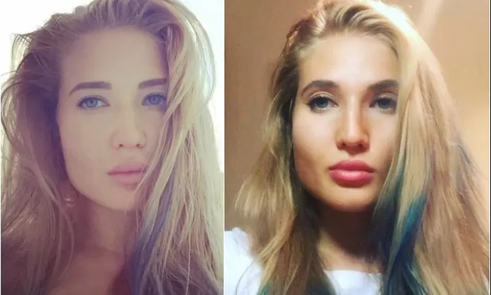Anastasia Yankova: así quedó la bella peleadora MMA tras dura pelea ...
